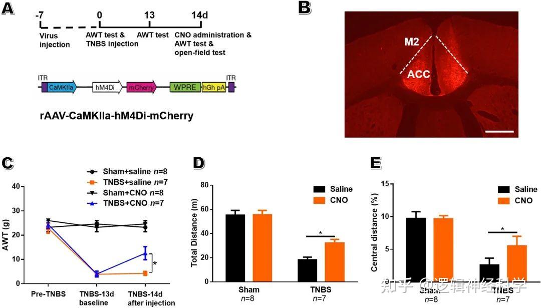 Neurosci Bull︱李云庆课题组揭示前扣带回内神经可塑性改变与慢性胰腺炎的痛觉过敏和焦虑有关 - 知乎