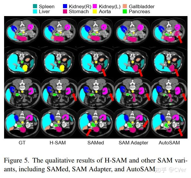 CVPR 2024 | 显著涨点！H-SAM：通过分层解码释放SAM在医学适应方面的潜力 - 知乎