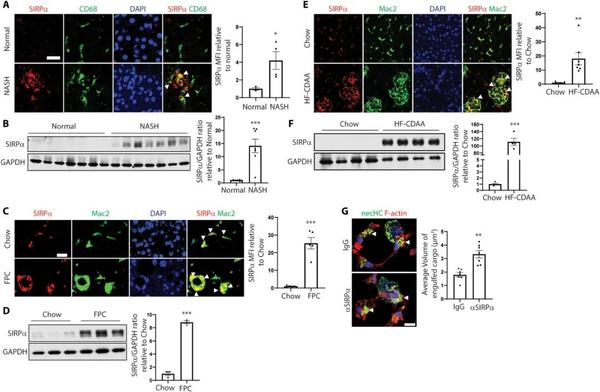 Sci Tra Med | 肝巨噬细胞清除肝炎中坏死肝细胞、减少肝纤维化 - 知乎