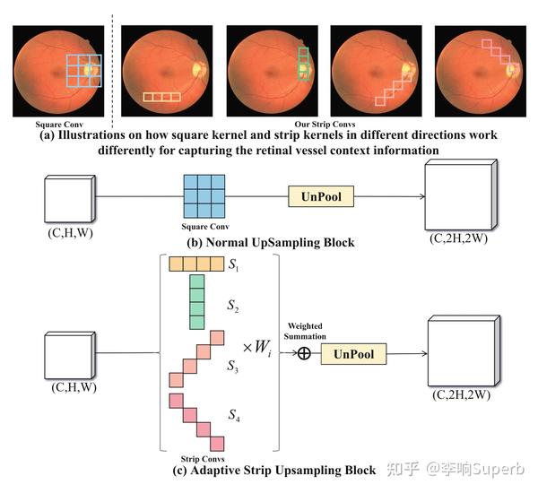 MICCAI 2022：使用自适应条形采样和双分支 Transformer 的 DA-Net - 知乎