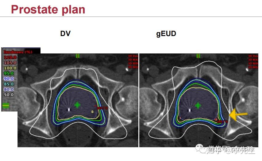 学习gEUD，用好gEUD（第二篇）。 - 知乎