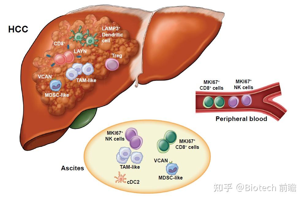 肝癌免疫治疗进展汇总及肝癌微环境中决定免疫疗法疗效的免疫屏障 - 知乎