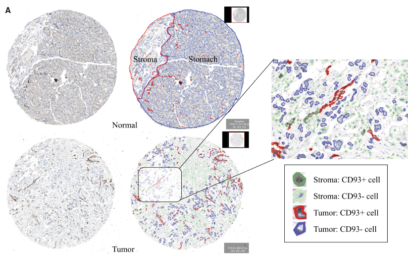 单基因分析新思路来袭——多组学分析+数字图像分析=8分+纯生信，运用多种数据库，创新性超赞!！ - 知乎
