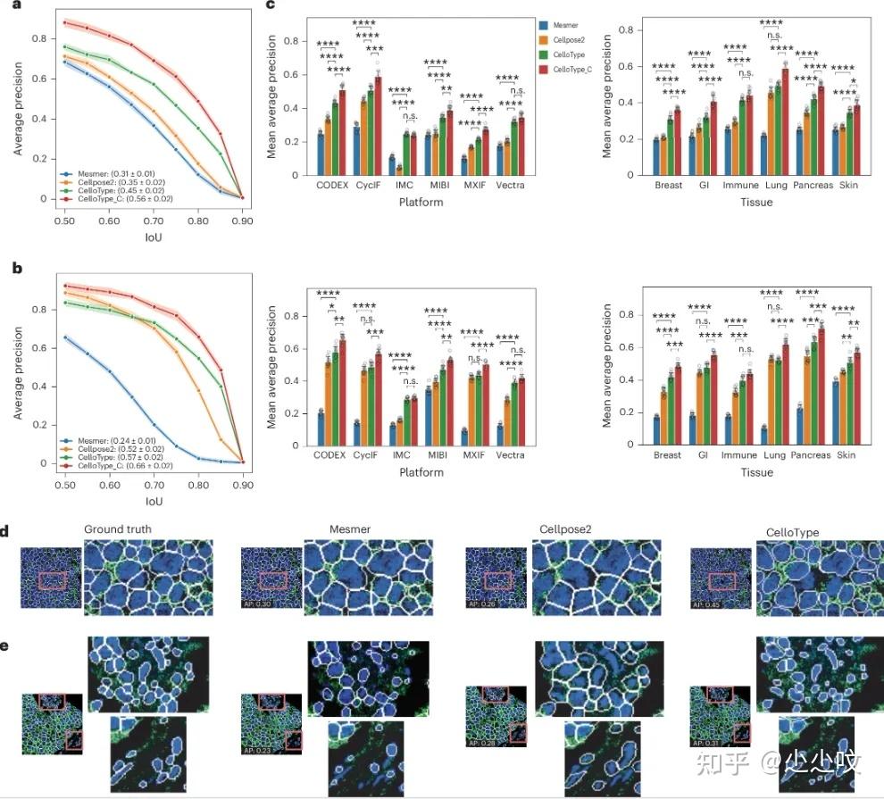 Nat Methods | CelloType：用于组织图像分割和分类的统一模型 - 知乎
