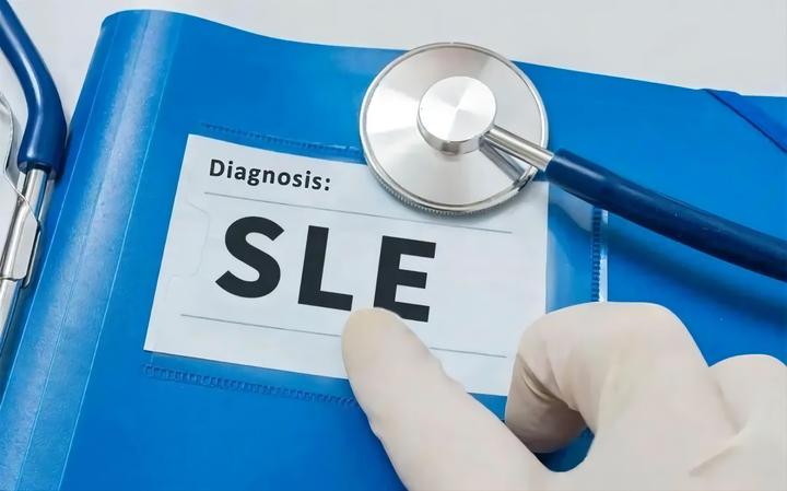 红斑狼疮：专家团队完成间充质干细胞治疗SLE（难治性红斑狼疮）1132例，取得良好效果 - 知乎
