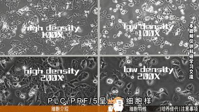 PLC/PRF/5细胞培养，人肝癌亚历山大细胞培养攻略 - 丰晖生物 - 知乎