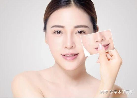 刷酸的那些副作用,你真的了解吗?毁脸太常见! 知乎