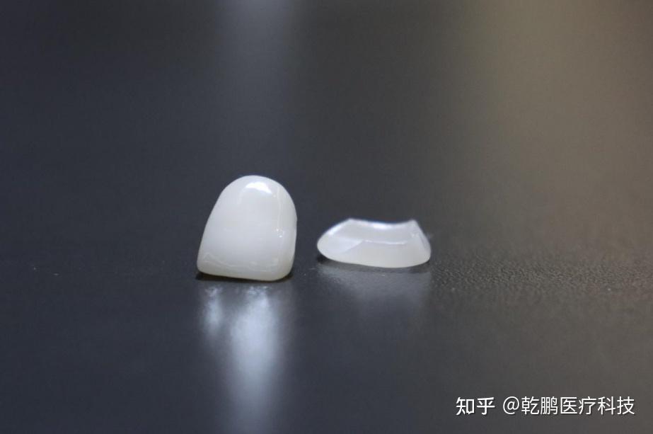 procera瑞典瓷全瓷牙有哪些优势？ - 知乎