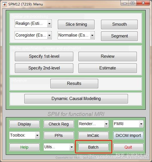 MRI数据预处理 - 知乎
