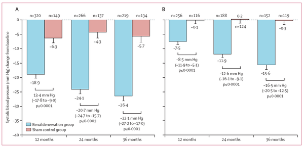 TCT 2022丨刘靖教授深度解读SYMPLICITY HTN-3研究：重燃RDN希望之光 - 知乎