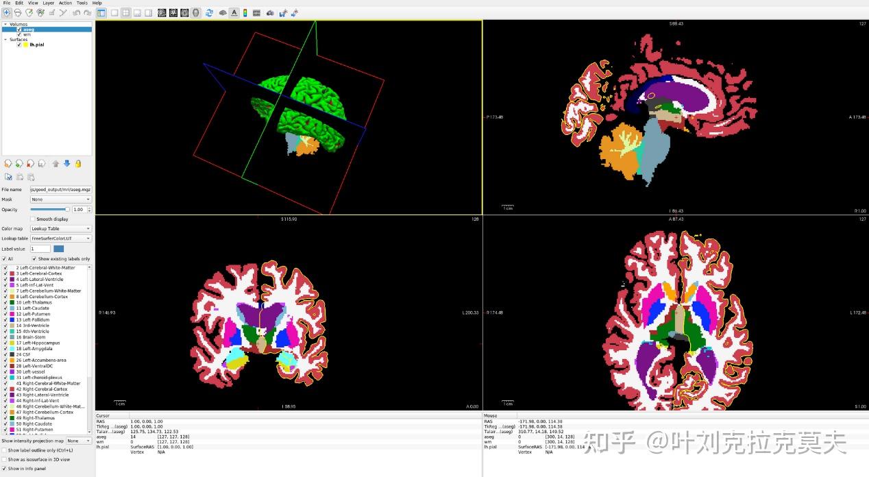科学可视化软件介绍 – 人类大脑MRI处理软件FreeSurfer - 知乎