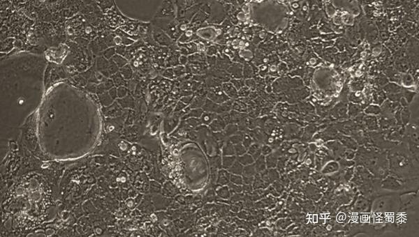 【整理】Caco-2人结直肠腺癌细胞培养经验 - 知乎