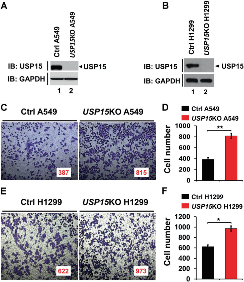 USP15通过TRAF6-BECN1信号轴诱导自噬对肺癌进展进行负向调节 - 知乎