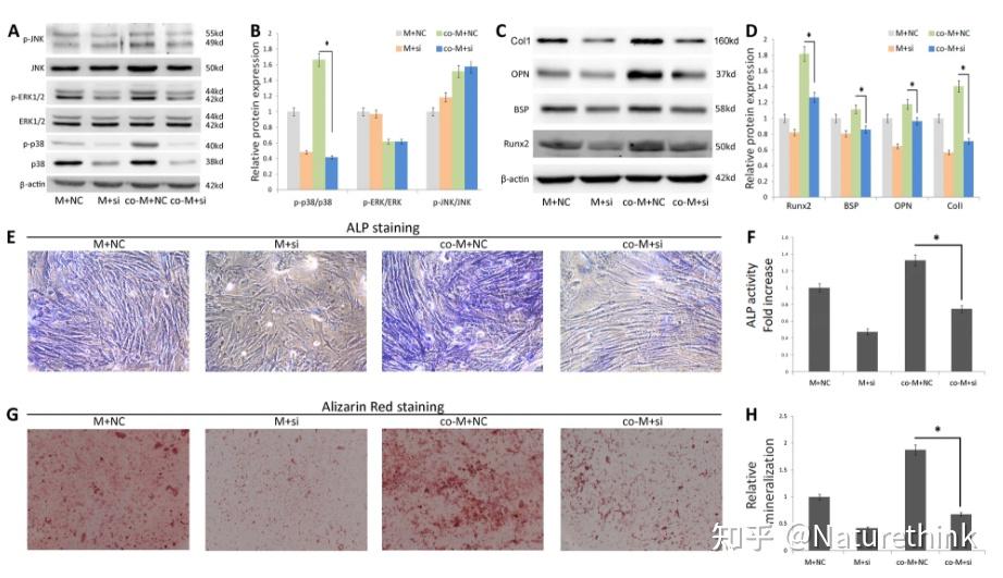 内皮祖细胞通过MAPK-依赖性通路促进共培养的间充质干细胞的成骨分化 - 知乎