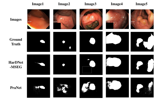 息肉分割网络：HarDNet-MSEG（86.7 FPS|0.904MDice - 知乎