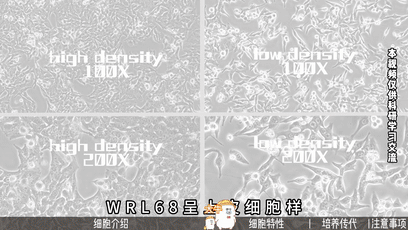 WRL68细胞培养， 人肝细胞培养攻略 - 丰晖生物 - 知乎