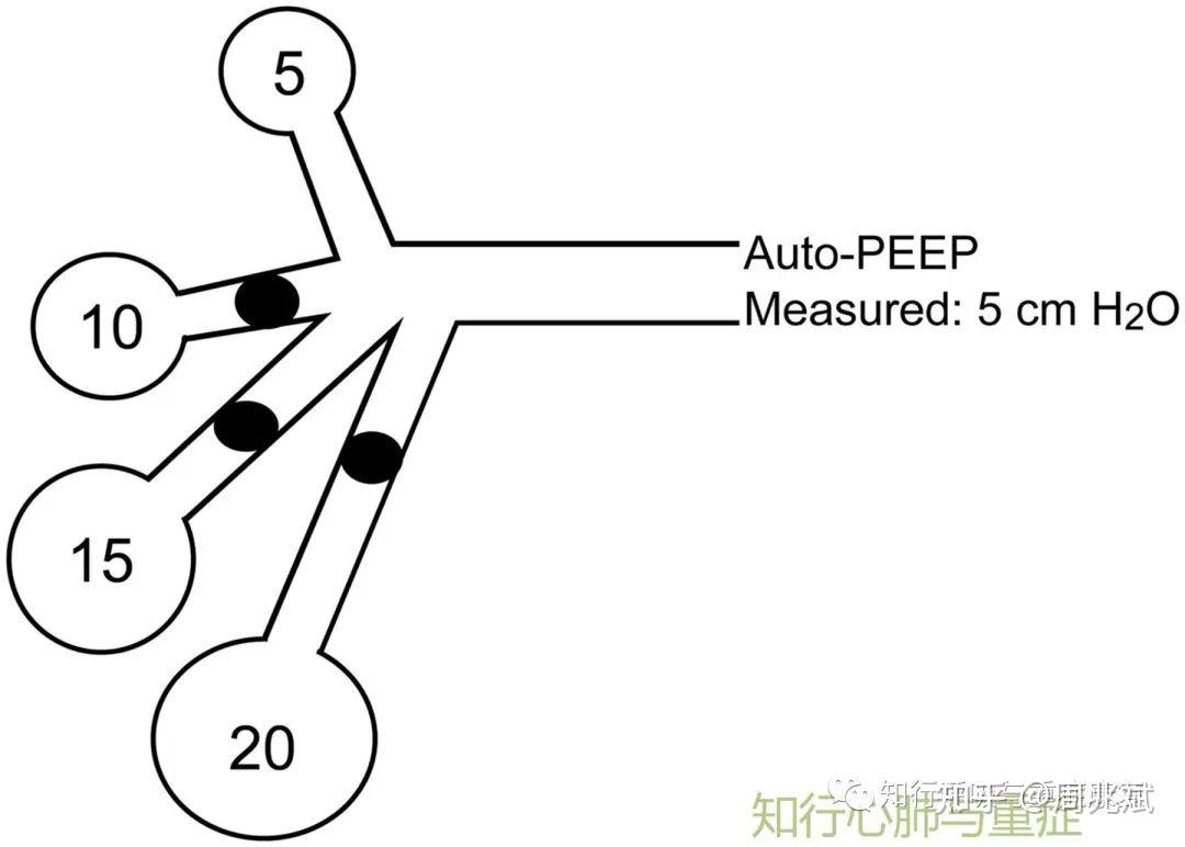 第142期 呼吸力学-从基础到临床 - 知乎