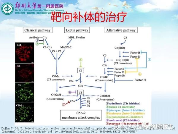 2022年ANCA相关血管炎诊疗进展 - 知乎