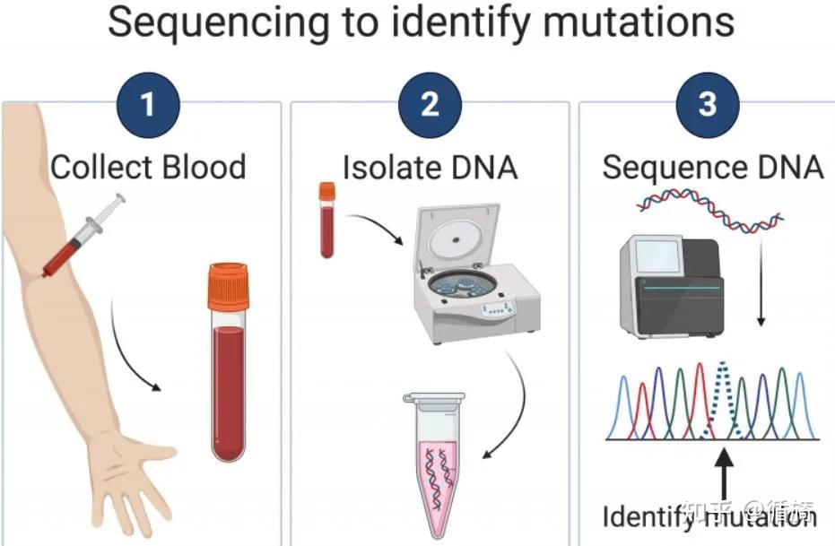 BEST1基因变异引起的黄斑营养不良征-卵黄蛋白病BVMD、AVMD、ARB、ADVIRC、RP - 知乎