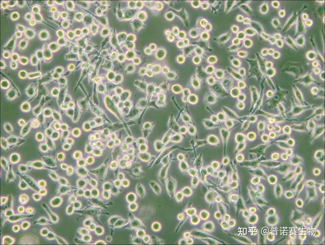 细胞学堂 | BV2细胞形态大变样，如何“力挽狂澜”？ - 知乎