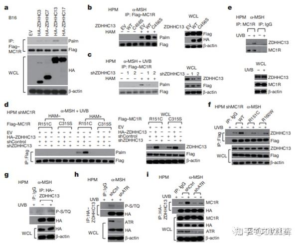 波士顿大学医学院崔儒涛团队揭示MC1R的棕榈酰化依赖性活化可防止黑色素瘤生成的作用机制 - 知乎