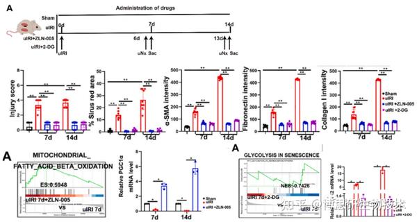Metabolism: 肾纤维化的新治疗靶点—周细胞代谢重编程 - 知乎