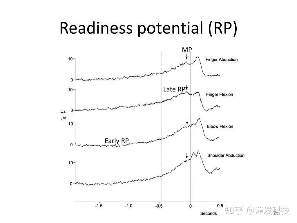 脑电常见的ERP成分 - 知乎