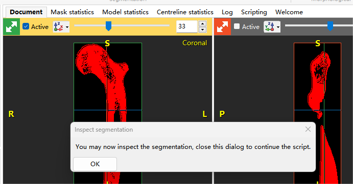 【Simpleware 教程】Simpleware 中的脚本功能 - 知乎