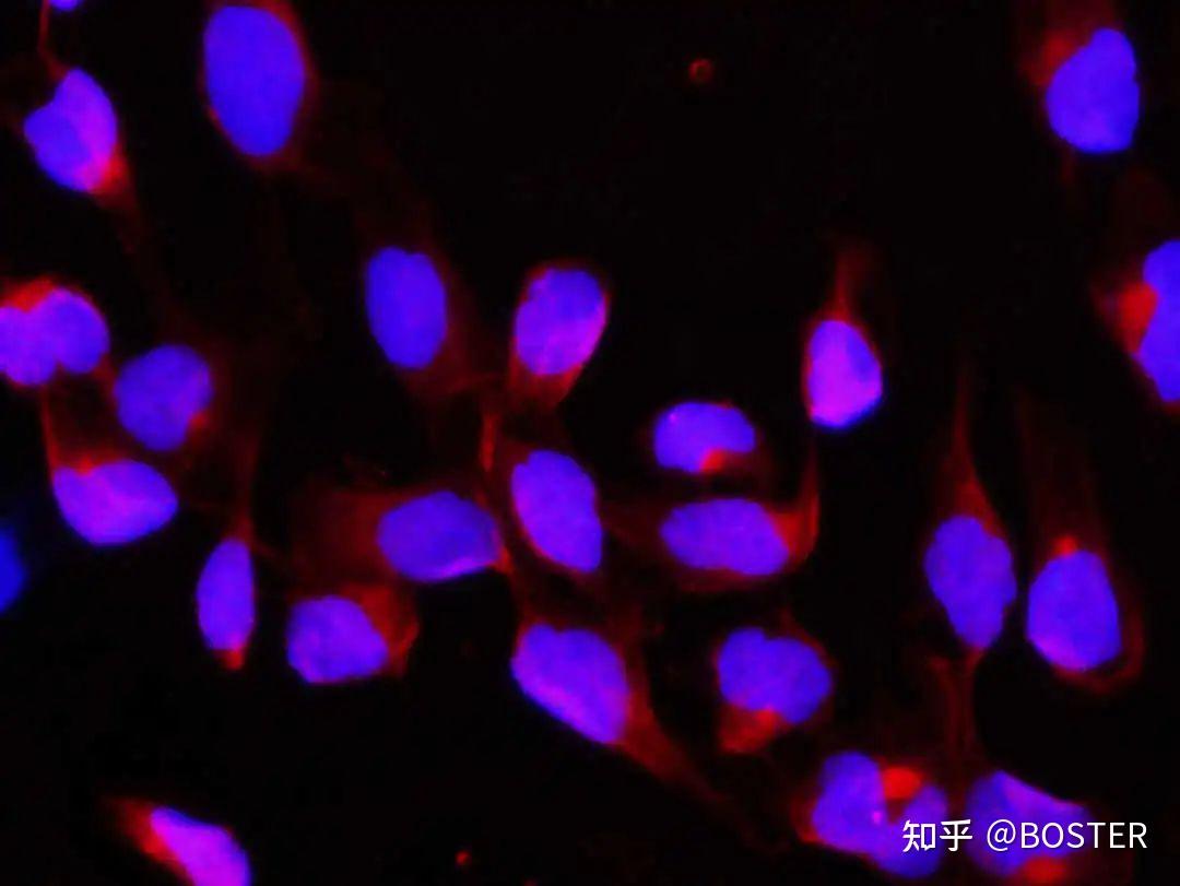 信号通路蛋白的免疫荧光检测 - 知乎
