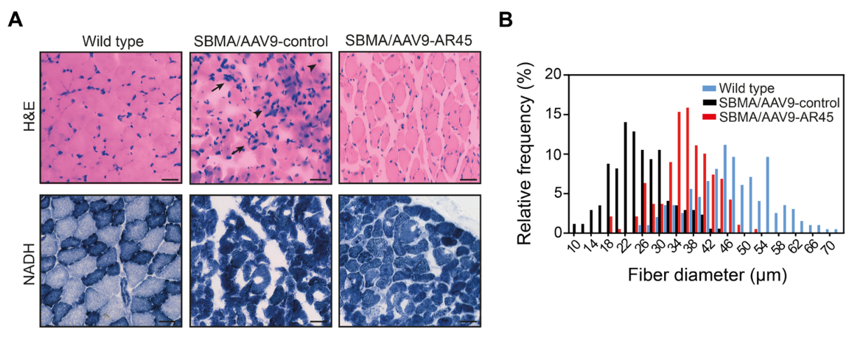 Science advances最新进展｜AR亚型2基因治疗通过抑制AR的转录活性改善脊髓延髓肌萎缩症 - 知乎