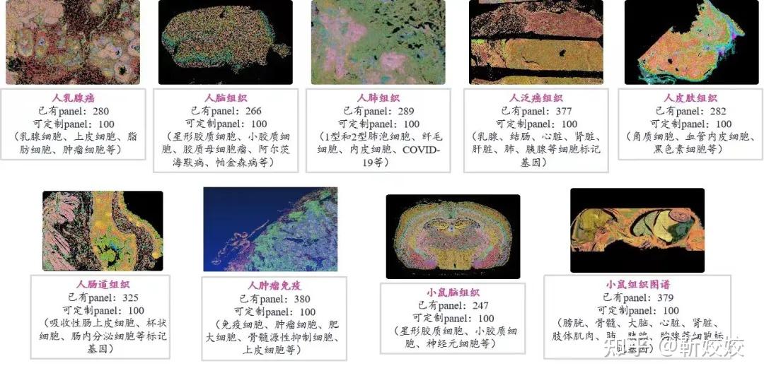 突破！10x Xenium技术基因原位检测新高度空间生物学文章大爆发？ - 知乎
