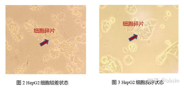 HepG2细胞培养攻略 - 知乎