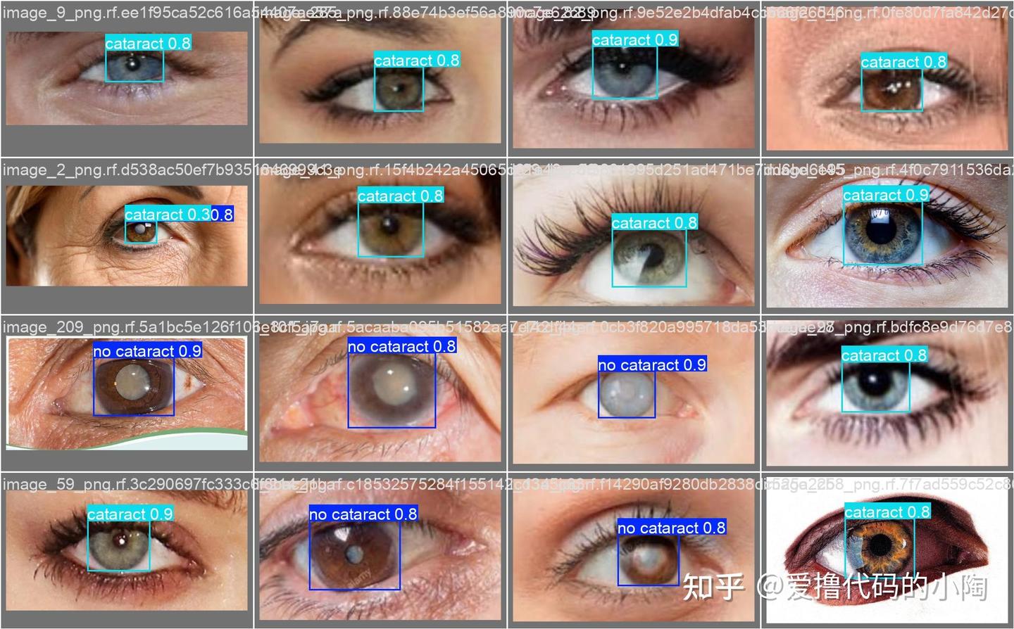 【目标检测】第2期 基于 YOLOv8深度学习的眼部检测系统 - 知乎
