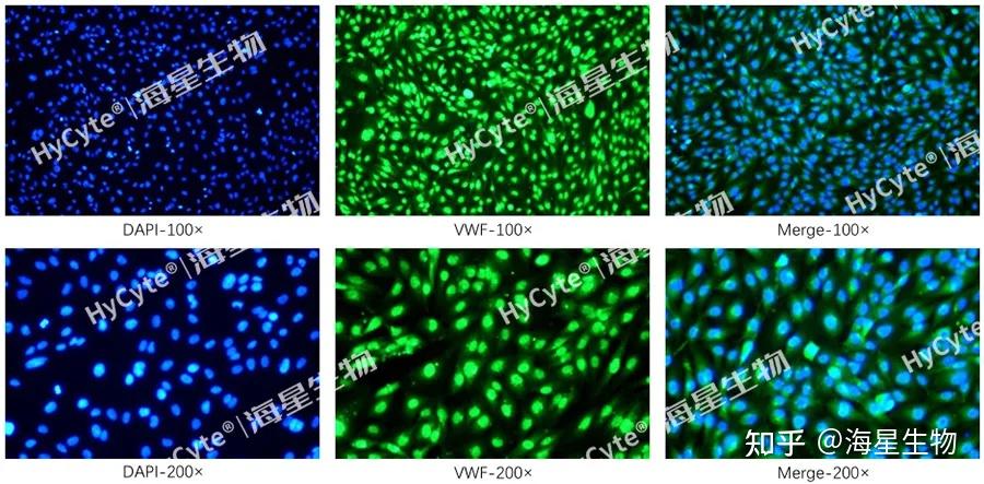 HUVEC人脐静脉内皮细胞血管形成实验与培养要点 - 知乎
