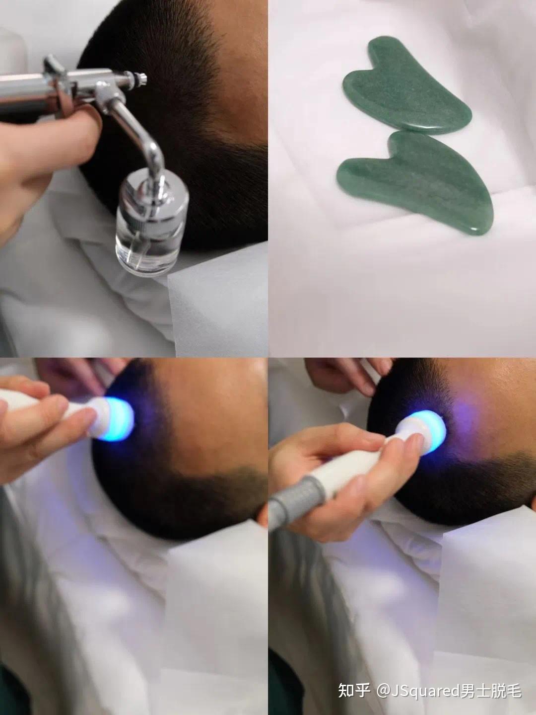 JSquared头皮养护项目上线｜来一场提升颜值的“上头”之旅 - 知乎