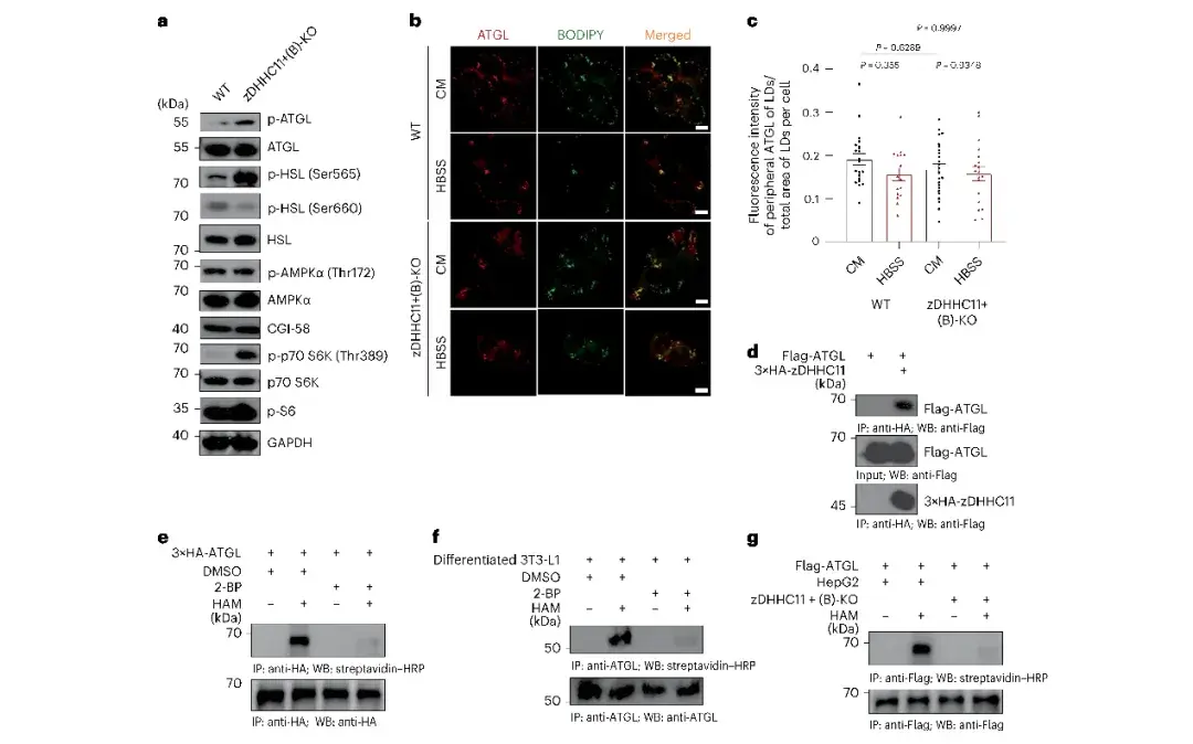 Nature Metabolism IF18.9｜ 浙江大学联合国外多研究团队揭示ATGL的S酰化调控脂滴稳态机制 - 知乎