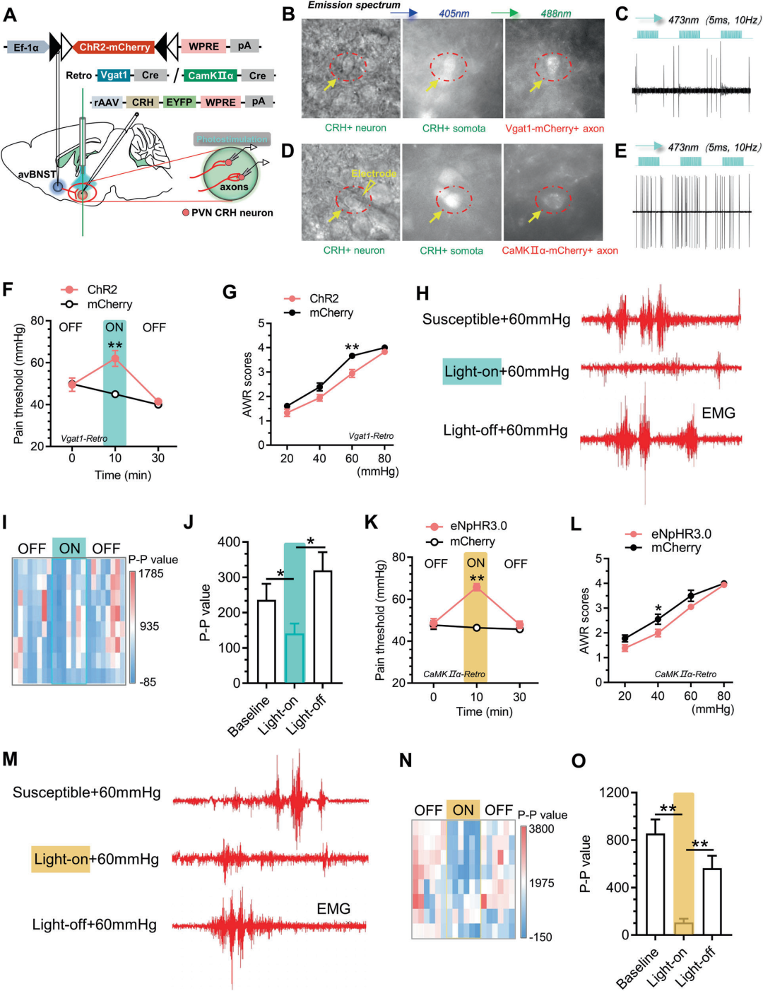 【客户文章】徐州医科大学张咏梅教授团队揭示avBNST-PVN神经环路介导生命早期应激致成年慢性内脏痛易感性的机制 - 知乎