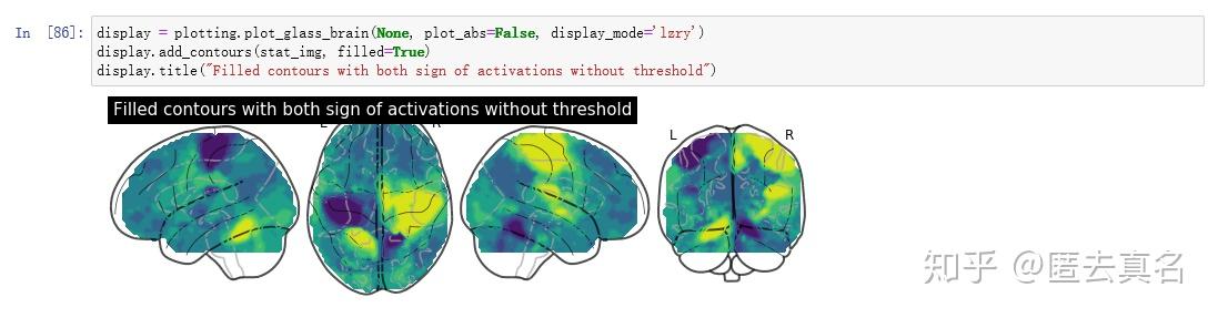 nilearn 笔记（6） - 知乎