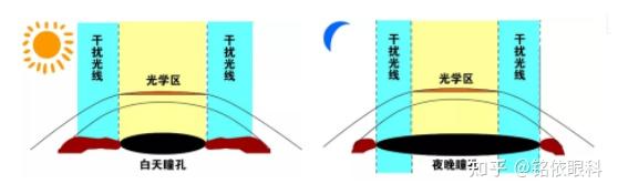 一等再等的ICL V5晶体究竟好在哪里？ - 知乎