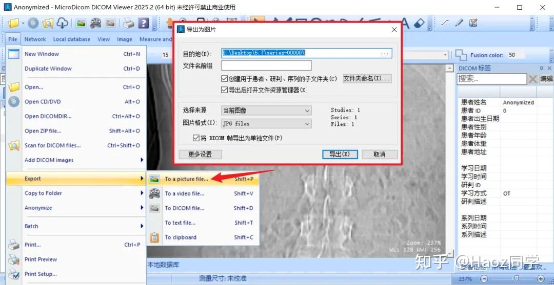DCM文件怎么打开|手把手教你如何把DCM文件转换为图片JPG格式 - 知乎