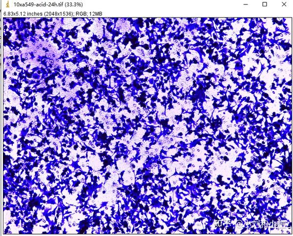 零基础SCI绘图（13）如何分析Transwell穿过小室的细胞数量 - 知乎