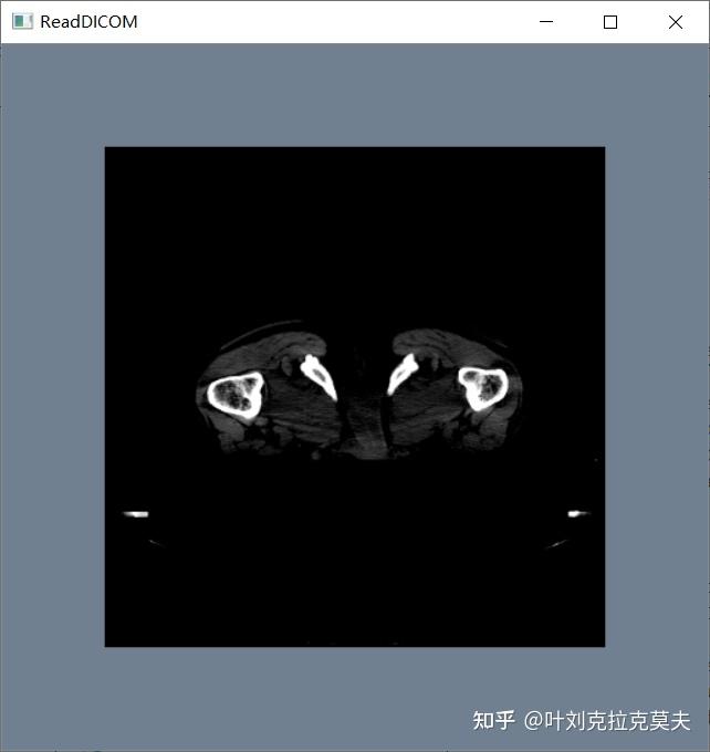 VTK官方示例Python版68 - ReadDICOM..py - 知乎
