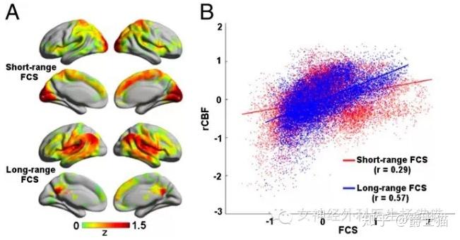 大脑之默认模式 默认网络DMN活动一致性有其结构连接的基础 - 知乎