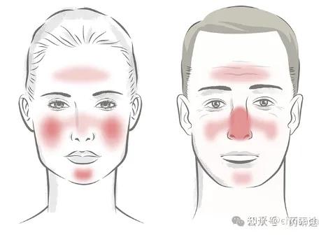 酒糟鼻/玫瑰痤疮口服治疗药物 | 盐酸米诺环素缓释胶囊（Emrosi）获FDA批准上市 - 知乎