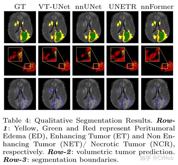 MICCAI 2022 | VT-UNet: 基于 3D UNet 架构的 Transformer 医学图像分割开篇之作！ - 知乎