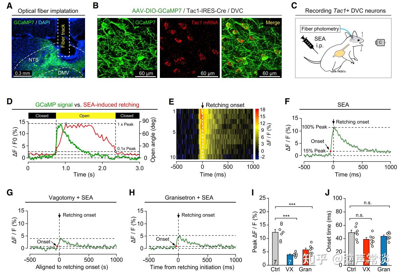 Cell丨北京生命科学研究所曹鹏课题组揭示背侧迷走复合体相关环路介导了食物中毒和化疗引起的防御反应 - 知乎