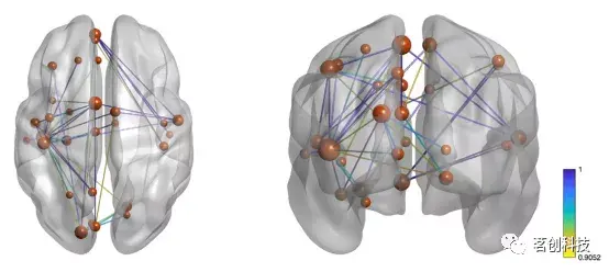 NBS-Predict：基于脑网络的机器学习预测 - 知乎