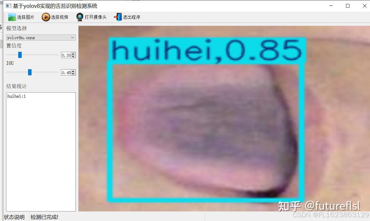 基于yolov8的舌苔识别检测系统python源码+onnx模型+评估指标曲线+精美GUI界面 - 知乎