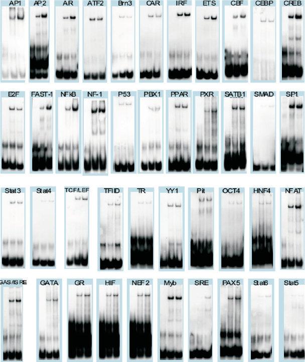 凝胶迁移实验（EMSA）实验方法 - 知乎