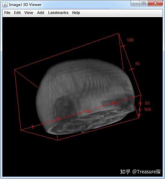 ImageJ实用技巧——3D可视化及测量(定量分析篇) - 知乎